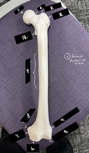 Extremity Anat Dry Lab Femur Patella Tibia Flashcards Quizlet