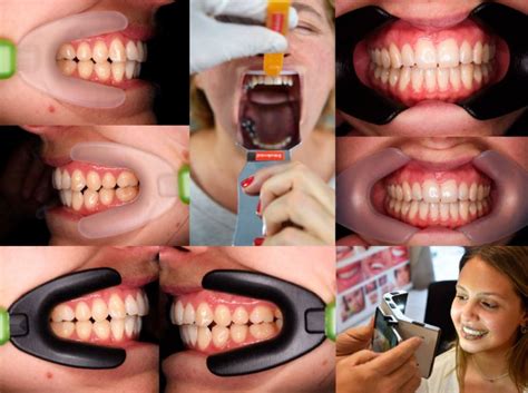 Curso de fotografía dental CIDESID Máster de implantología y