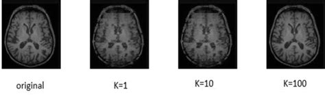 figure 6 from securing medical images using compression techniques with encryption and image