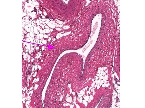 Blood Vessel Histology Flashcards Quizlet