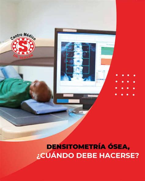 Densitometría ósea cuándo debe hacerse Centro Médico Dr Serván