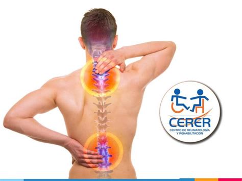 Espondilitis Anquilosante DOLOR LUMBAR CRÓNICO CERER