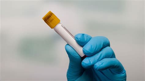 Química Sanguínea de 45 elementos