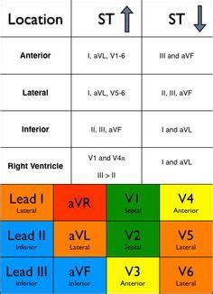 12 Lead Ekg Interpretation Cheat Sheet Cheat Sheet