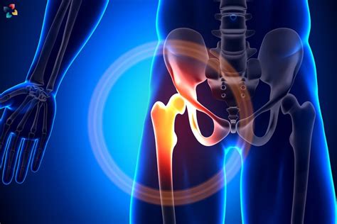 Hip Flexor Pain Anatomy Causes Symptoms Diagnosing And Treatment