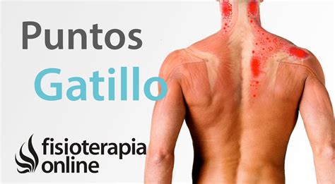 Qu Son Los Puntos Gatillo O S Ndrome De Dolor Miofascial Y Su