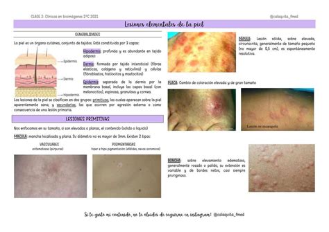 CLASE 2 Lesiones Elementales De La Piel Calaquita Study UDocz