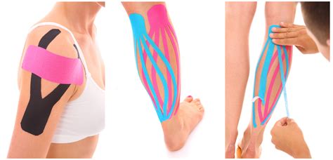 Kinesiotape Qué es y cómo funciona Fisiomarket Blog