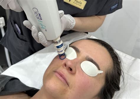 Harmony Xl Pro Clearlift Mediface Aesthetics Doncaster