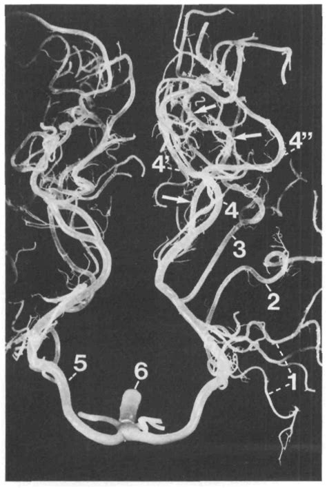 Figure 1 From Distribution Of The Occipital Branches Of The Posterior