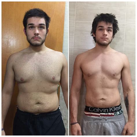 Excesso de pele solução Sala de avaliação Antes e depois Fórum