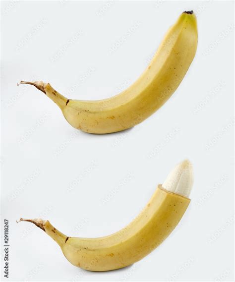 Circumcision Before And After Stock Photo Adobe Stock