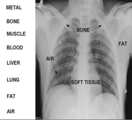 Intro To Radiology Flashcards Quizlet