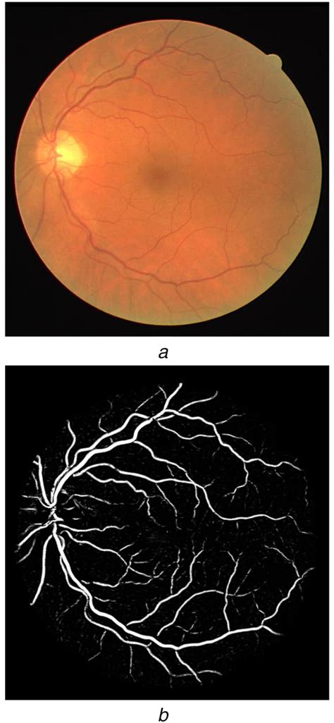 retinal vessel segmentation using neural network thangaraj 2018 iet image processing