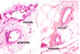 Food Steward Poetry Arteriola Microscopio Wizard Meditation Break Up
