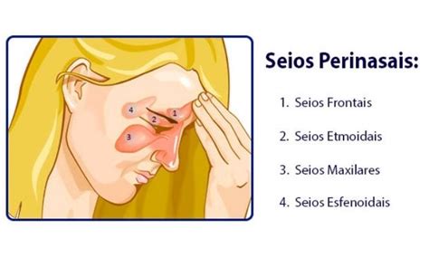 Sinusite o que é sintomas tipos causas tratamento