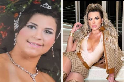 A Fazenda 14 Antes e depois de procedimentos estéticos choca Veja