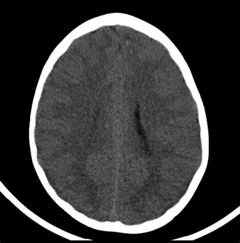 Image Radiopaedia Org