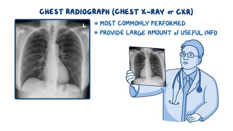 Frontiers AI Based Radiodiagnosis Using Chest X Rays A 53 OFF