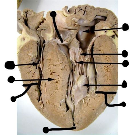 Frontal Section Sheep Heart Diagram Quizlet