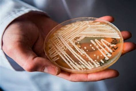 Brasil registra primeiro caso de infecção por superfungo considerado