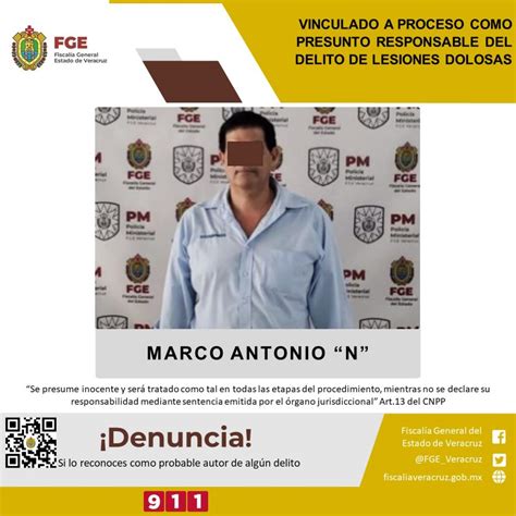 Vinculado A Proceso Como Presunto Responsable Del Delito De Lesiones