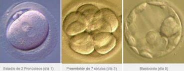Cultivo De Embriones Medicina Reproductiva Grupo Gamma