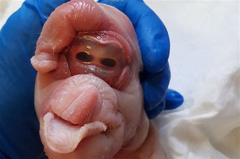 Large Head Of Penis Blog Beyin