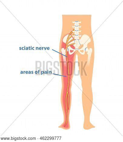 Sciatic Nerve Vector Photo Free Trial Bigstock