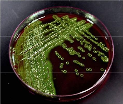 E Coli On Macconkey Agar