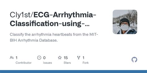 ecg arrhythmia classification using artificial neural network preprocessing py at master