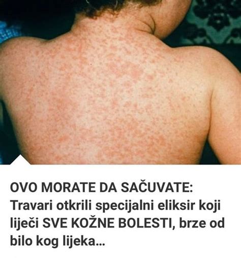 OVO MORATE DA SAČUVATE Travari otkrili specijalni eliksir koji liječi