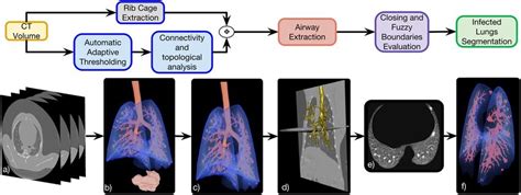 automatic lung segmentation pipeline a source chest ct volume b download scientific