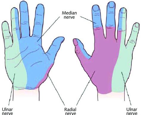Pin By Sarah Vanbergen On Anatomy Median Nerve Ulnar Nerve Radial Nerve