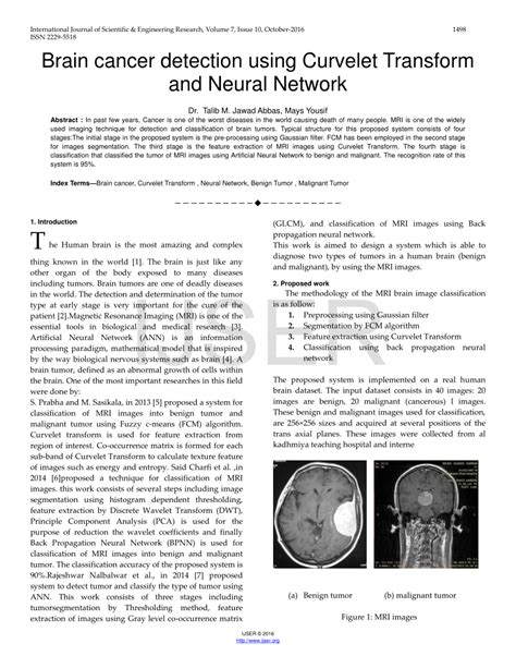 pdf brain cancer detection using curvelet transform and neural network