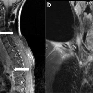 A Magnetic Resonance Imaging MRI Sagittal T1 Weighted Sequence With