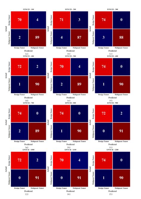 tunicate swarm algorithm with deep convolutional neural network driven colorectal cancer