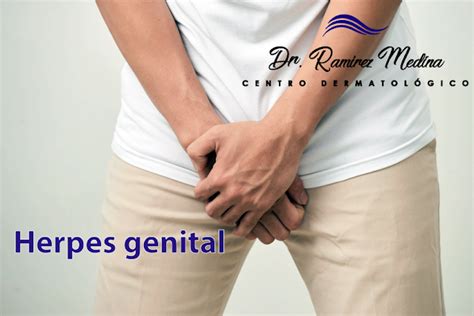 Centro Dermatológico Dr Ramírez Medina Sección Hombres HERPES GENITAL