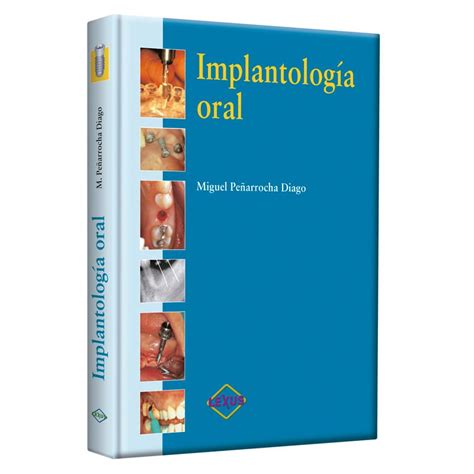 Peñarocha Implantología Oral 1 Tomo Lexus Editores Colombia
