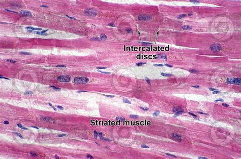 Man Cardiac Muscle Longitudinal Section X Man Mammals
