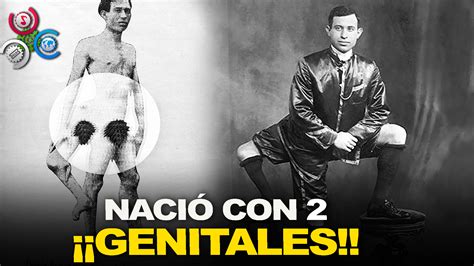 Conoces la historia de Francesco Lentini El hombre que nació con 3