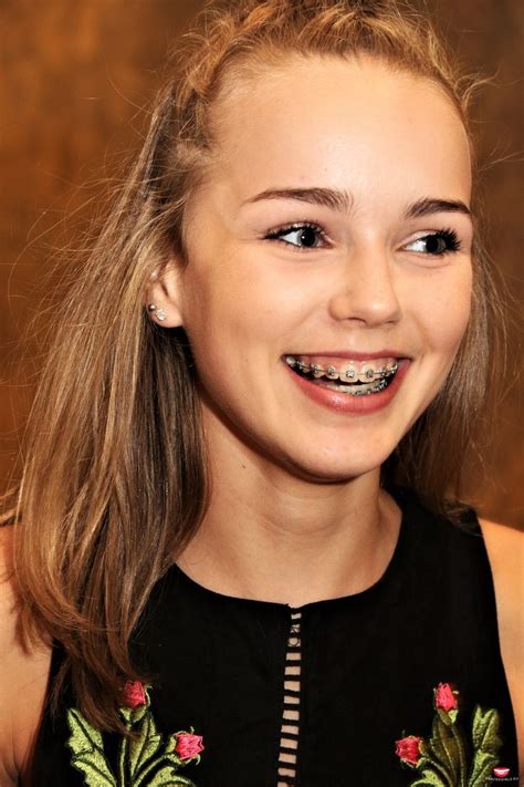 Adult Braces Braces Girls Cute Braces Dental Braces Teeth Braces