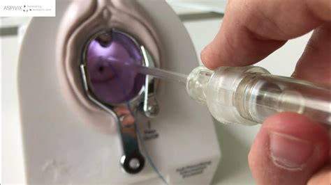 Demo Video Of Iud Insertion With Aspivix Randd Youtube