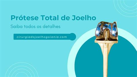 Prótese Total De Joelho Saiba Todos Os Detalhes