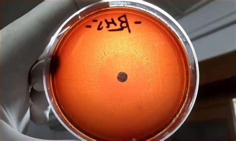 Neomycin Blood Agar Introduction Principle Composition Preparation