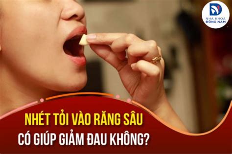 Nhét TỎI vào răng sâu có giúp giảm đau không Nha Khoa Đông Nam