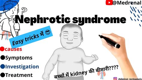 Nephrotic Syndromecause Easy Trick Symptom Investigation