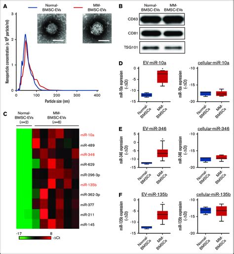 Identification Of MM BMSC Specific EV MiRNAs A Representative