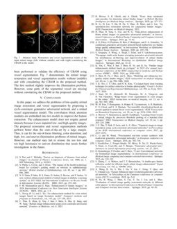 Retinal Image Restoration And Vessel Segmentation Using Modified Cycle