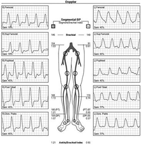 Computational Methods To Automate The Initial Interpretation Of Lower